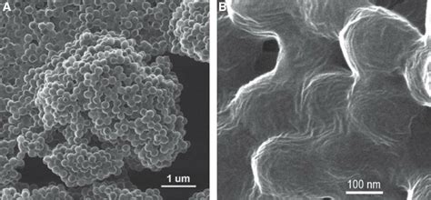 Him Imaging Of Pvdf Pani Core Shell Nanoparticles A Nanoparticle Download Scientific Diagram