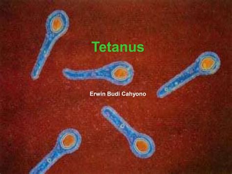 438217395 Tetanus Tetanus Tetanus Tetanhs Pptx