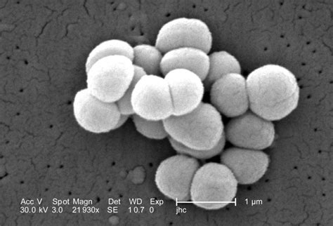 Micrococcus Alchetron The Free Social Encyclopedia