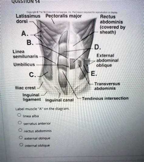 Tendinous Intersection
