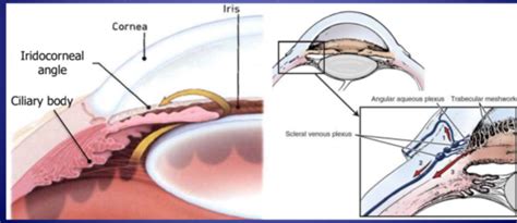 Glaucoma Flashcards Quizlet