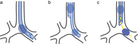 Persistent Air Leak In The Critically Ill Bja Education