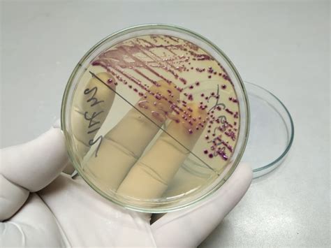 Coliform Scientific Methods
