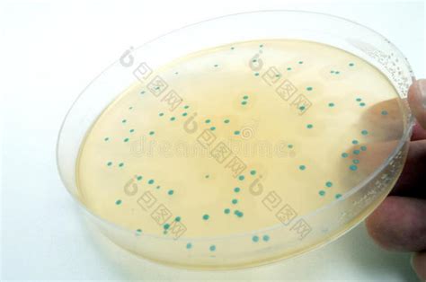 培养皿中的霉菌生长图片 包图网企业站