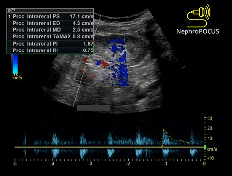 Pocus Quiz For Vexus Enthusiasts Image Obtained From A Patient With