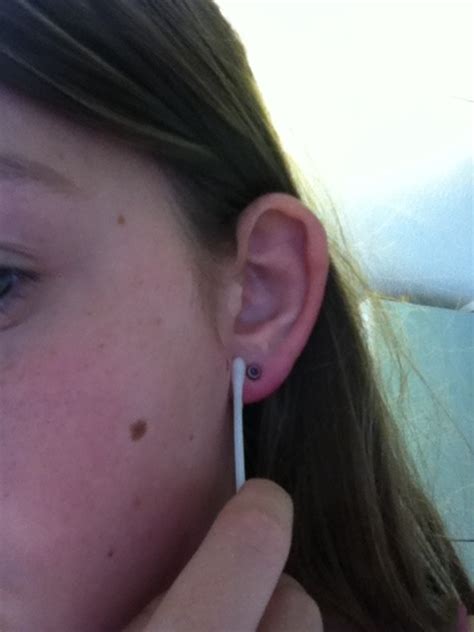 Infected Ear Piercing Hole