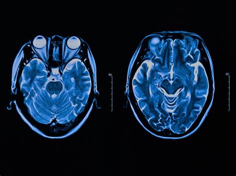 Microsoft ќе го користи човечкото тело за да генерира криптовалути Конект мк