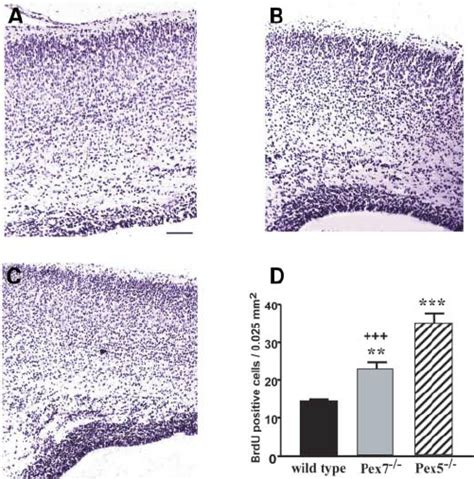 Neuronal Migration Defect In Pex7 À À Mice A C Cresyl Violet Download Scientific Diagram
