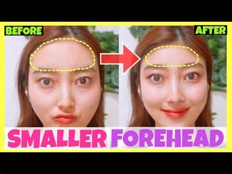 Make Your Forehead Smaller With This Exercise Get Narrow Forehead Naturally Artofit