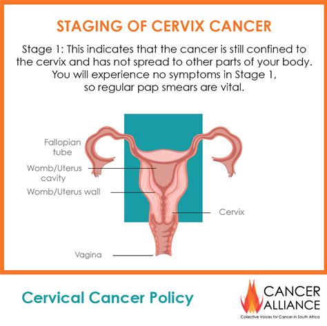 Cervical Cancer Policy 4 Timely Treatment And Palliative Care For Invasive Cervical Cancer