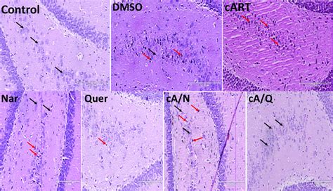 Cornu Ammonis Area 3 Ca3 Of Hippocampus Control Showing Normal