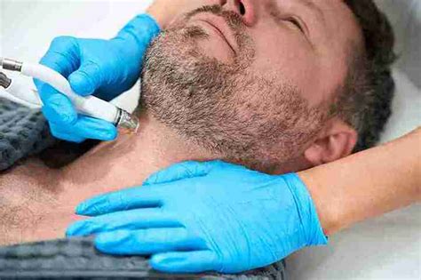 Mesoneedling Treatment Guide And Its Benefits