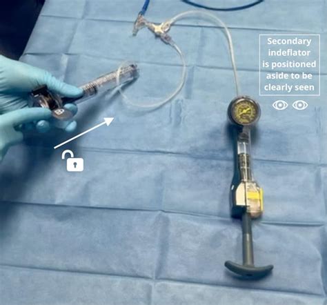 Simplified Dual Indeflator Approach For Bioprosthetic Valve Fracture