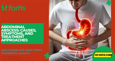 Abdominal Abscess Causes Symptoms And Treatments
