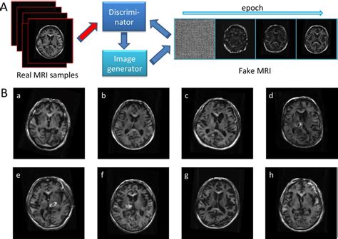 Work Flow Chart A Generative Adversarial Networks Gans Are Based Download Scientific