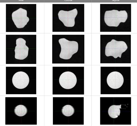 Table 1 From Impact Of Mri Resolution For Linac Based Stereotactic Radiosurgery Semantic Scholar