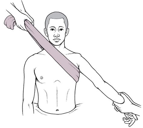 Imagetraction Countertraction Technique For Reducing Anterior Shoulder Dislocations Msd Manual