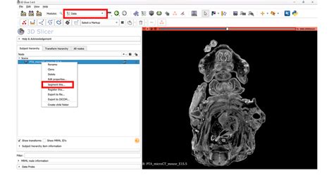 Github Sperrine3dslicersegmentationtutorial