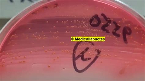Enterococcus Introduction Morphology Pathogenicity Lab Diag