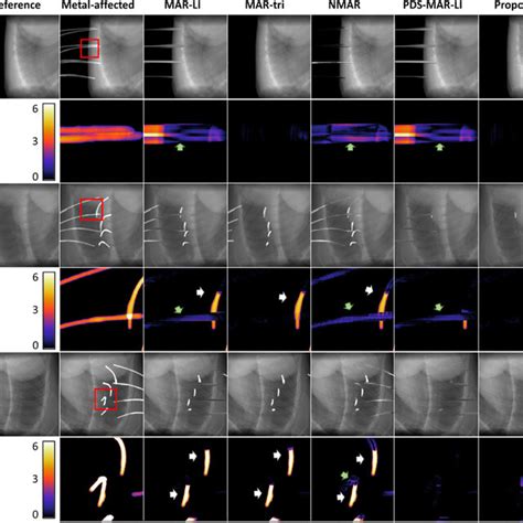 Projection Domain Interpolation Results On 3 Different Views With The Download Scientific
