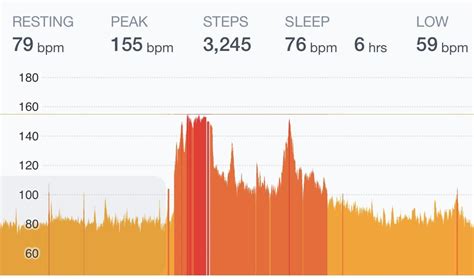Pots Heart Rate Graphs R Pots