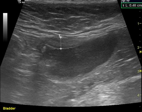 Interstitial Cystitis Suspected In A 13 Year Old Mn Dsh Cat Members