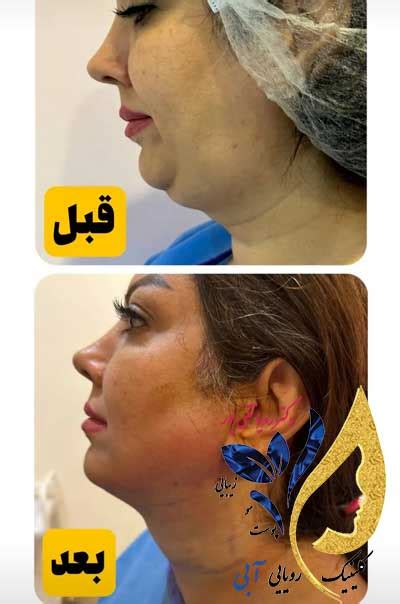 گالری عکس کلینیک زیبایی رویایی آبی 🧡💛