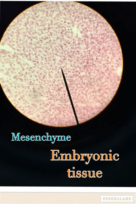 Mesenchyme Embryonic Tissue Tissue Histology Slides Medical