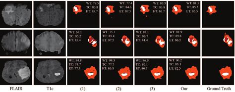 Figure 1 From Latent Correlation Representation Learning For Brain Tumor Segmentation With