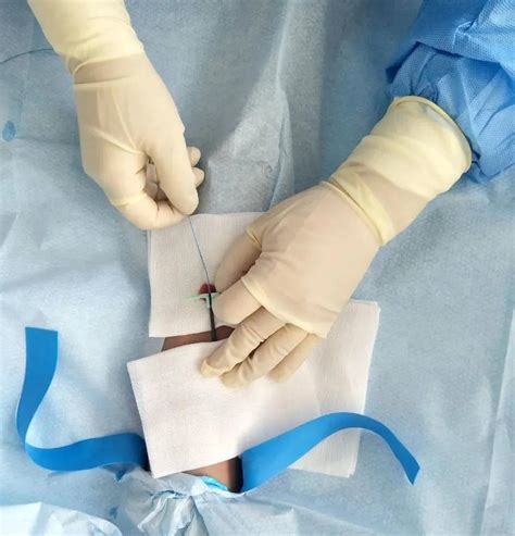 Picc置管图片 千图网