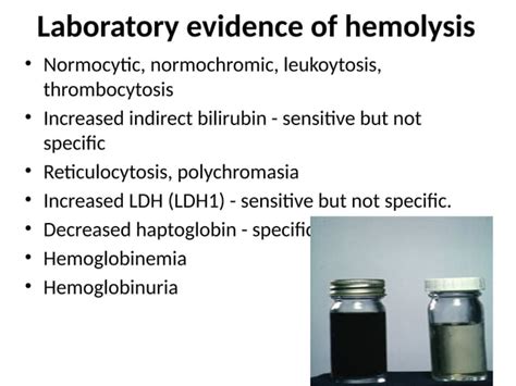 Anemia Classification Basic Lab Diagnosispptx