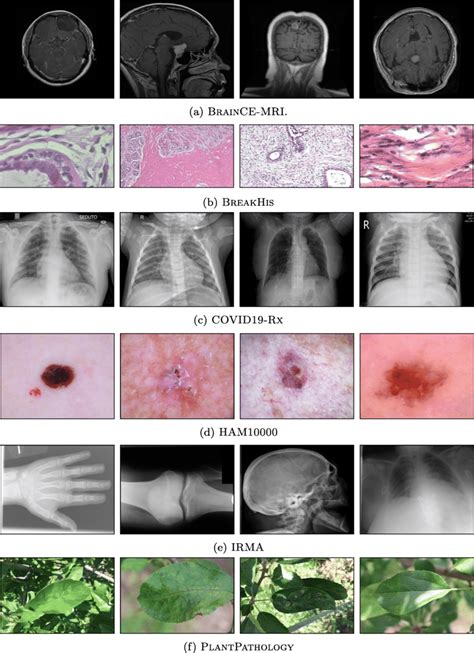 Example Images From The Biomedical Datasets Figure Best Seen In Color