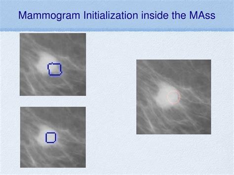 Ppt Mri Brain Extraction Using A Graph Cut Based Active Contour Model Powerpoint Presentation