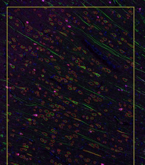 seeking advice on refining cellpose detection in qupath usage and issues image sc forum
