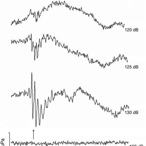 Example Of Auditory Evoked Potential Aep Waveforms For A Juvenile