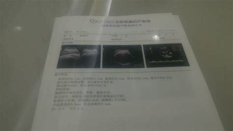 孕晚期b超单子怎么看男女 双顶径和股骨长判断生男生女 随意云