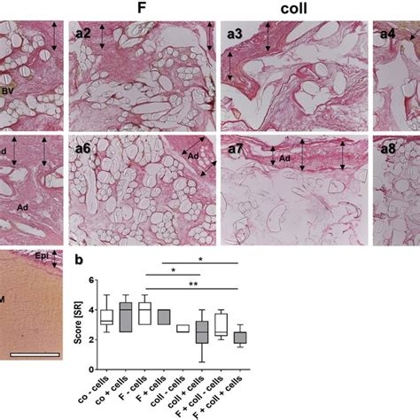 Visualization Of Collagen In The Different Scaffold Variants Explanted Download Scientific