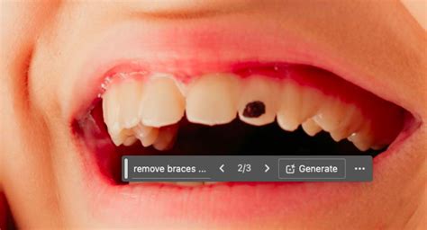 How To Remove Braces And Fix Teeth With AI In Photoshop