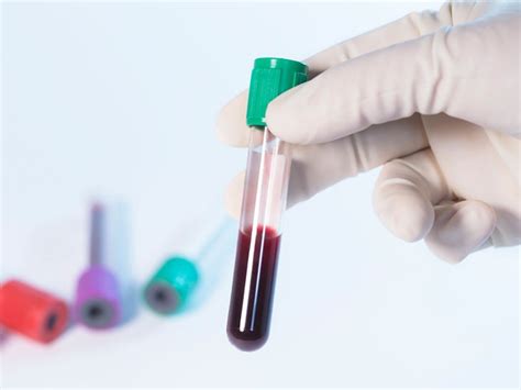 Platelet Aggregation Test Purpose Procedure And Risks