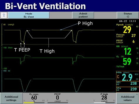 Ppt The “how To” Of Bivent Aprv Powerpoint Presentation Id348789