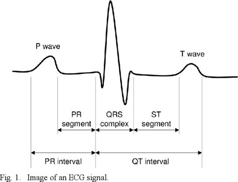 Figure 1 From Ecg Denoising Using Multiple Approaches Semantic Scholar