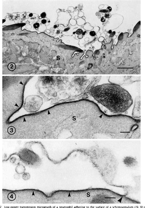 Figure 1 From Partial And Complete Detachment Of Neutrophils And