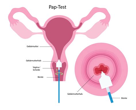 Alles über Den Pap Test Gyntect
