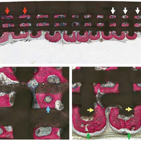 Dipyridamole Coated β Tcp Scaffold Assessment Quadrant Scaffold