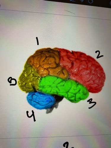 Sheep Brain Flashcards Quizlet
