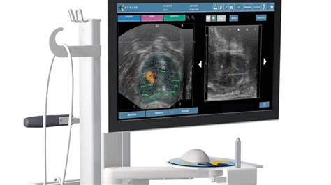 New Prostate Pathway Mātai Medical Research Institute