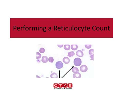 Ppt Performing A Reticulocyte Count Powerpoint Presentation Free