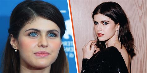 Alexandra Daddarios Eyes Netizens Thoughts About Her Striking Facial