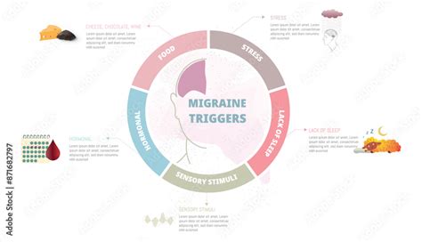 Diagram Of Migraine Ncepts Causes Migraines The Diagram Is Divided Into Five Sections