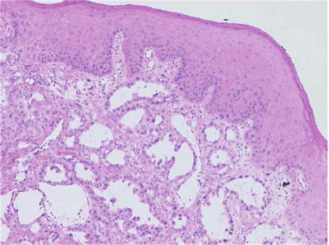 Digital Volume Tomography Sagittal Is Showing No Download Scientific Diagram